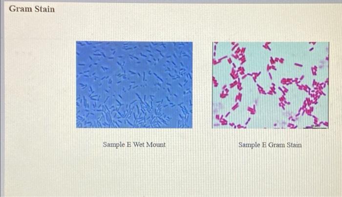 Bacillus Cereus Gram Stain