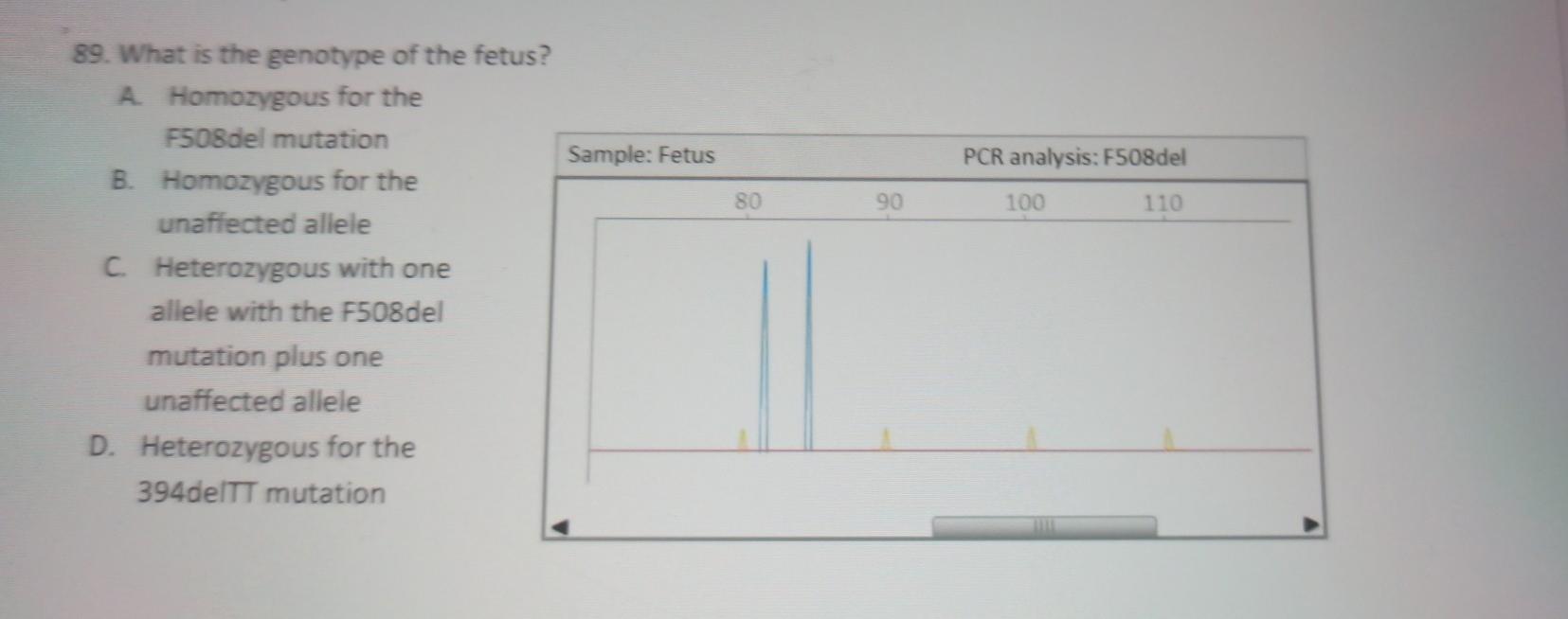 Solved Sample: Fetus PCR analysis: F508del 80 90 100 110 89. | Chegg.com