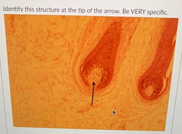 Solved Identify this structure at tge tip of the arrow. Be | Chegg.com Solved Identify this structure at tge tip of the arrow. Be | Chegg.com
