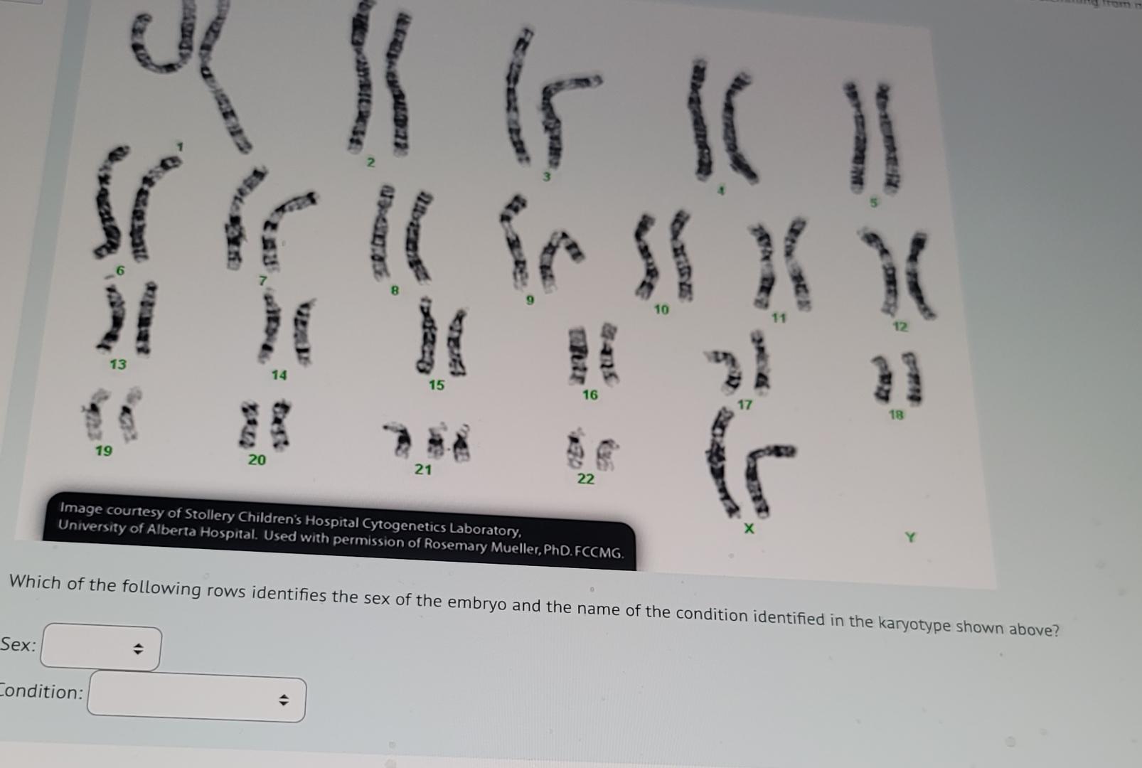 Solved Which Of The Following Rows Identifies The Sex Of The
