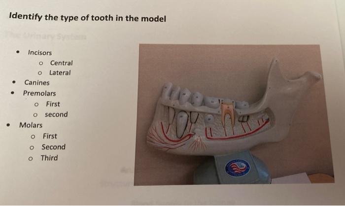 Solved Identify the type of tooth in the model . . Incisors | Chegg.com