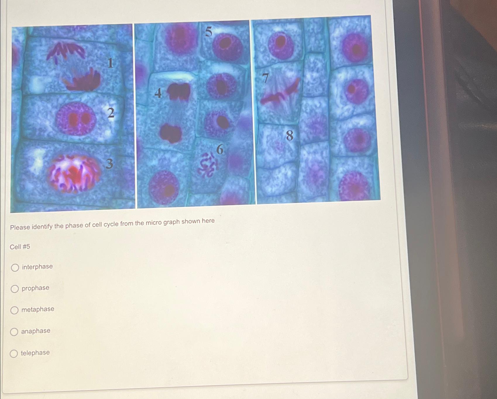 Solved Please identify the phase of cell cycle from the | Chegg.com