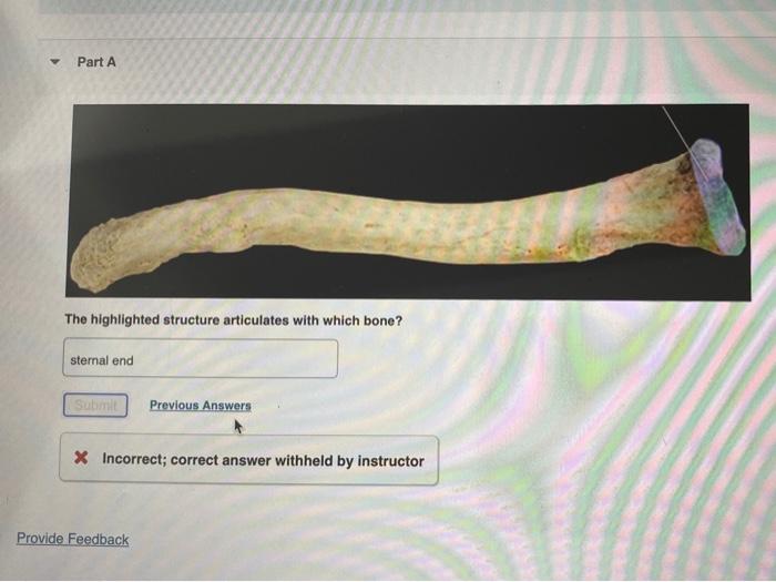 Solved Identify the highlighted structure. Spine process | Chegg.com