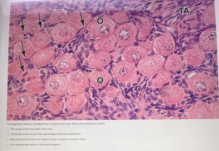 Solved The image above shows a micrograph from a section of | Chegg.com