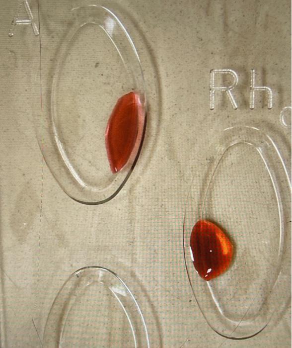 Solved Rh B O A+ OA- OB- OB- O O+ o o O AB+ AB- | Chegg.com