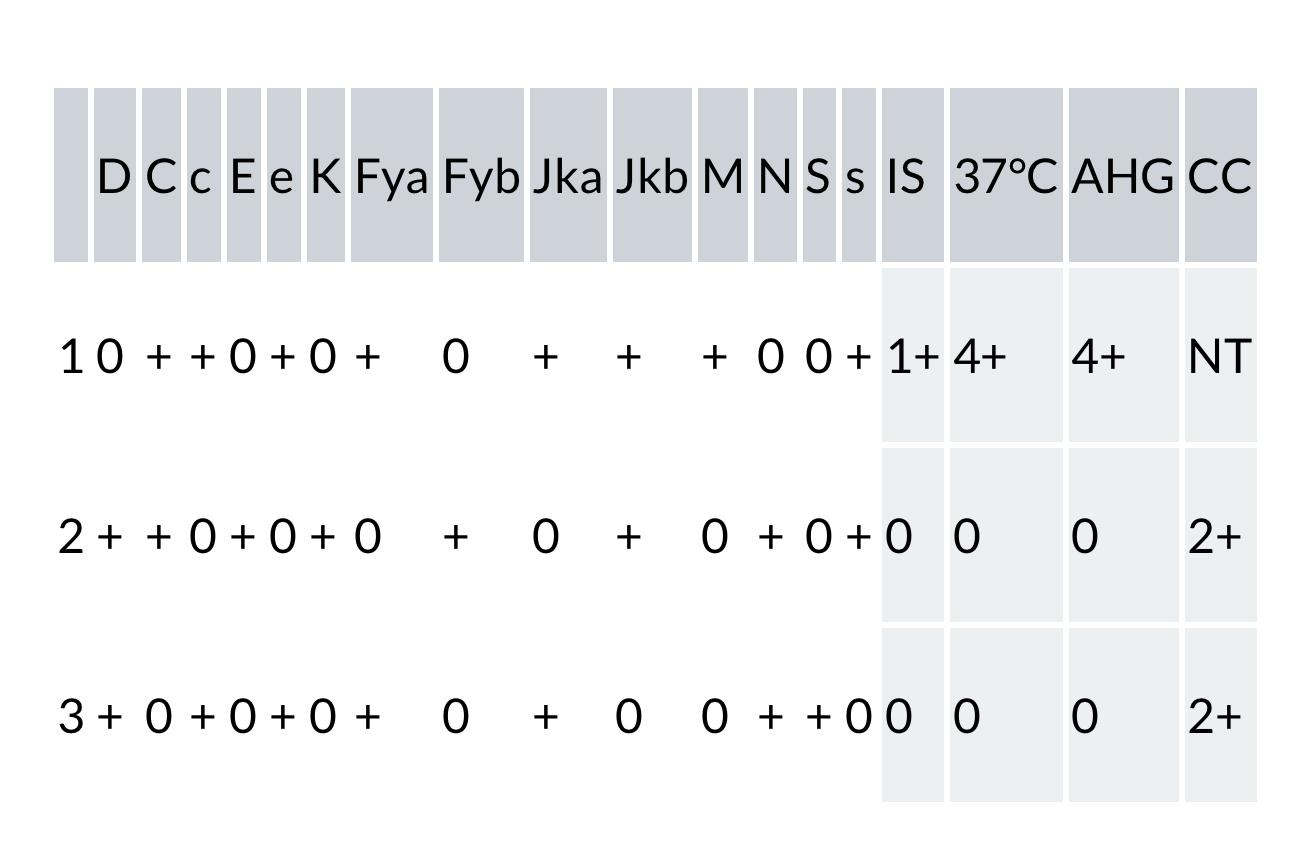 Solved For each case indicate:a. ﻿Is the discrepancy with | Chegg.com