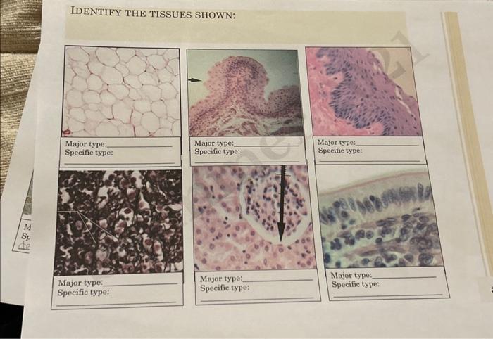 IDENTIFY THE TISSUES SHOWN:IDENTIFY THE TISSUES | Chegg.com