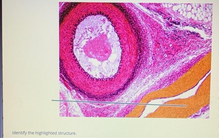 Solved Identify the highlighted structure. Identify the | Chegg.com