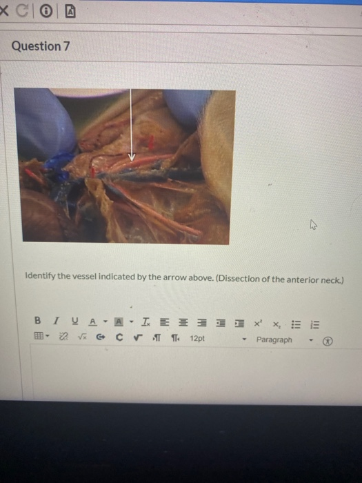 Solved XC 0 В Question 7 Identify the vessel indicated by | Chegg.com