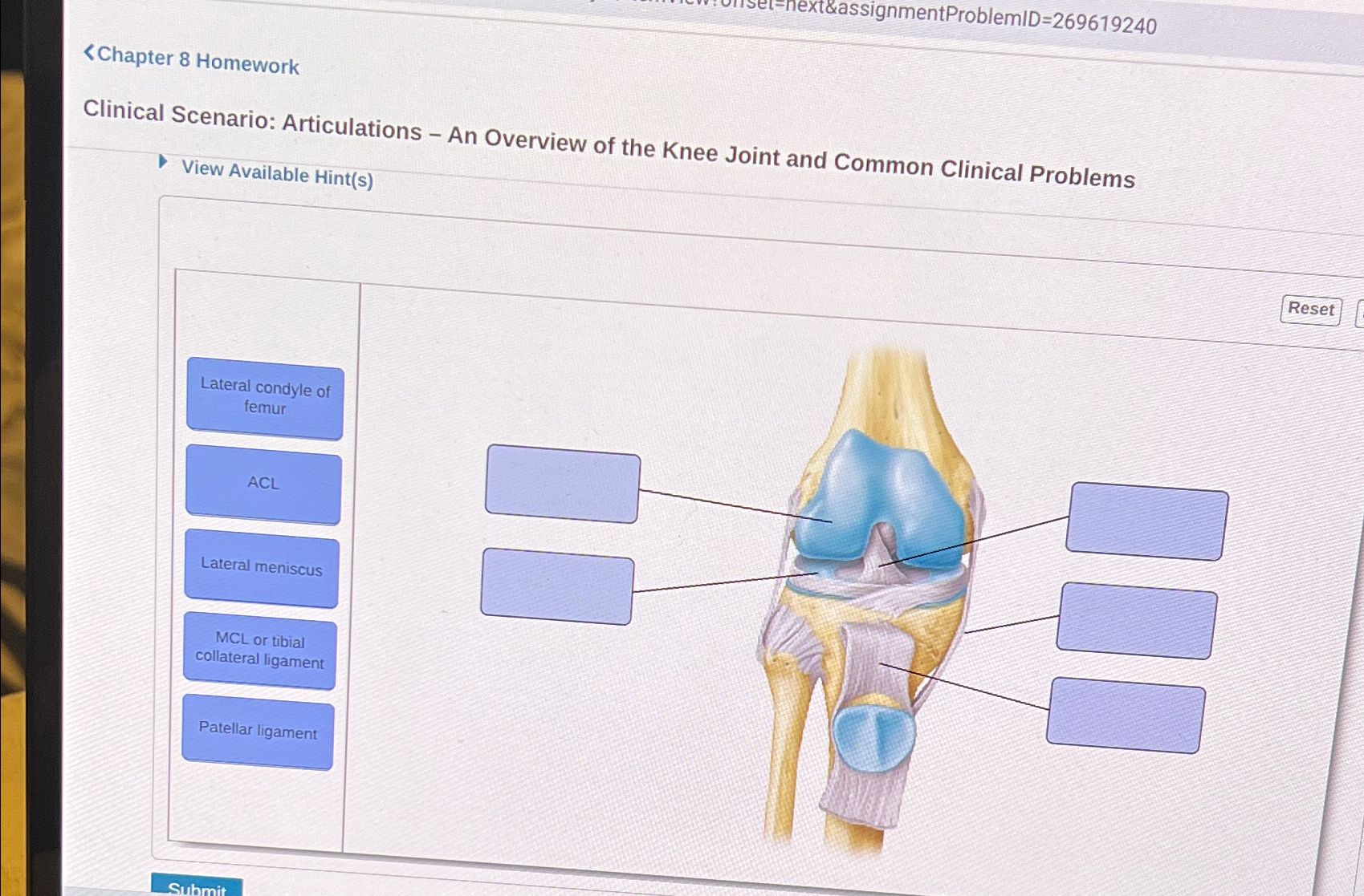 Solved Overview of knee joint and common clinical problems | Chegg.com