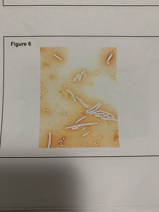 Solved 77) Refer to Figure 6. The results of this stain can | Chegg.com