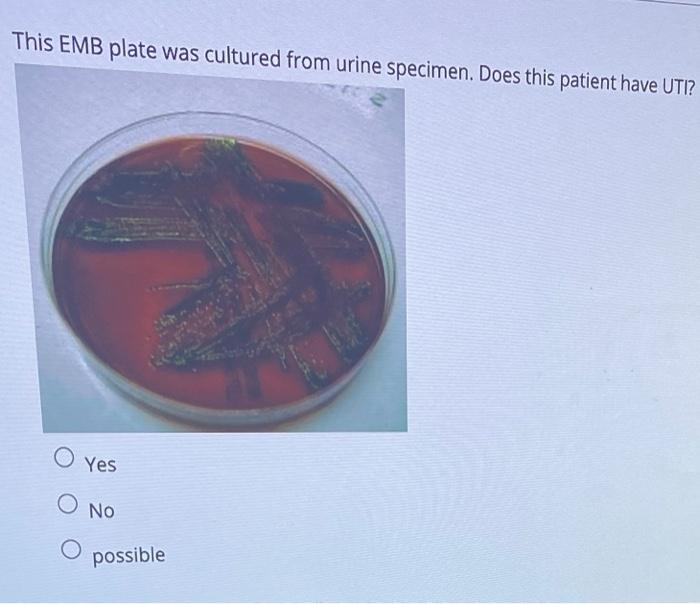 Solved This EMB plate was cultured from urine specimen. Does | Chegg.com