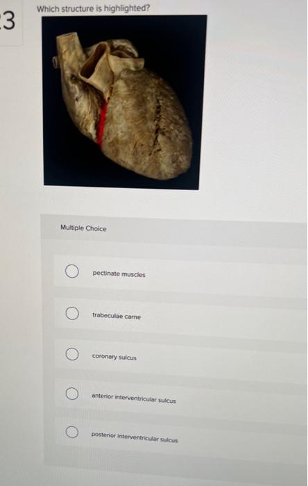 Solved Which structure is highlighted? Multiple Choice | Chegg.com