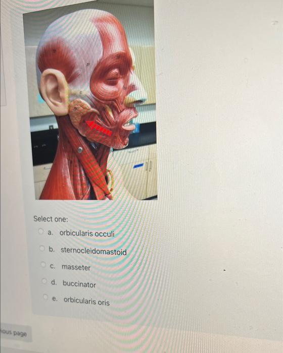 Solved a. orbicularis occuli b. sternocleidomastoid c. | Chegg.com