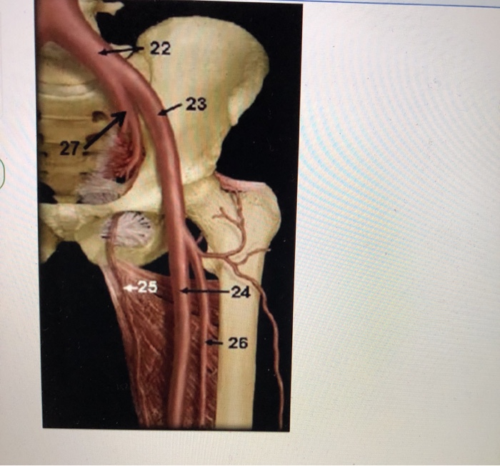 Identify the blood vessel labeled A. Note: You must | Chegg.com