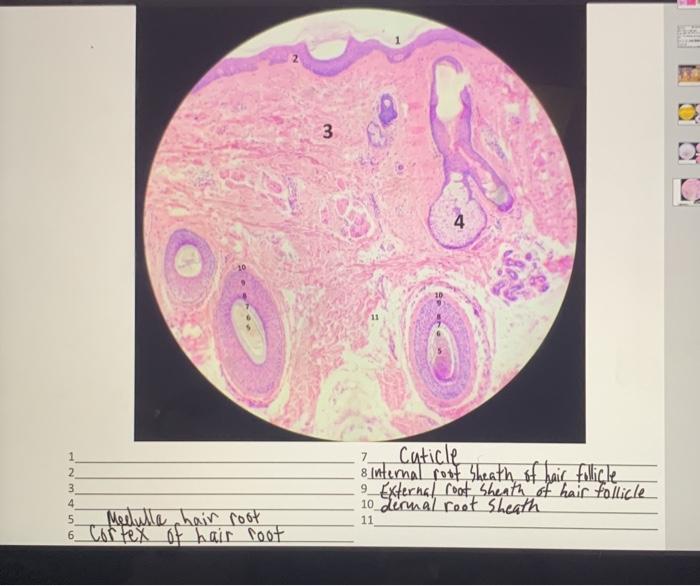 Solved 3 10 7 1 2 3 4 5 Caticle 8 Internal root Sheath of | Chegg.com