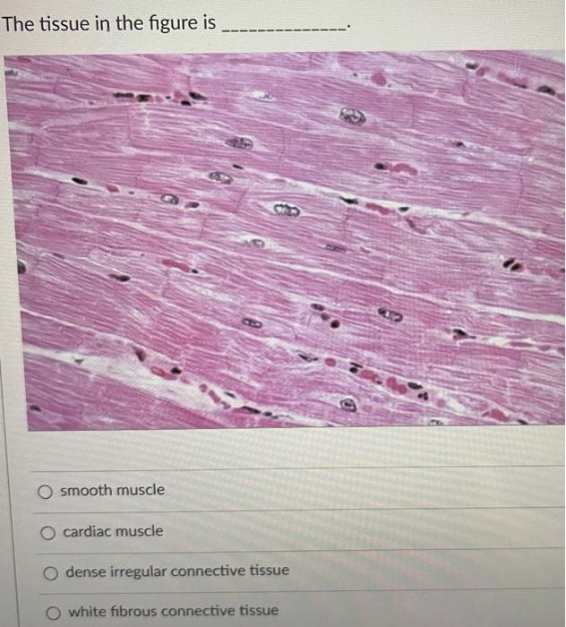 Solved The tissue in the figure is simple columnar | Chegg.com