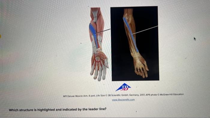 Solved WomN Jbsermificcom Which structure is highlighted and | Chegg.com