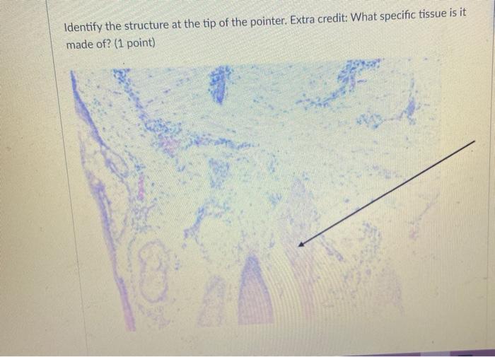 Solved Identify the structure at the tip of the pointer. | Chegg.com