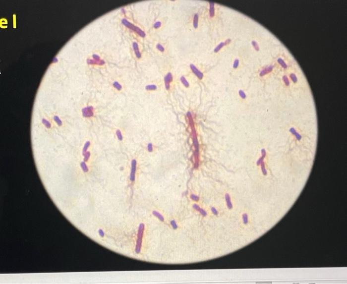 Solved which wet mount represents the flagella stain of | Chegg.com