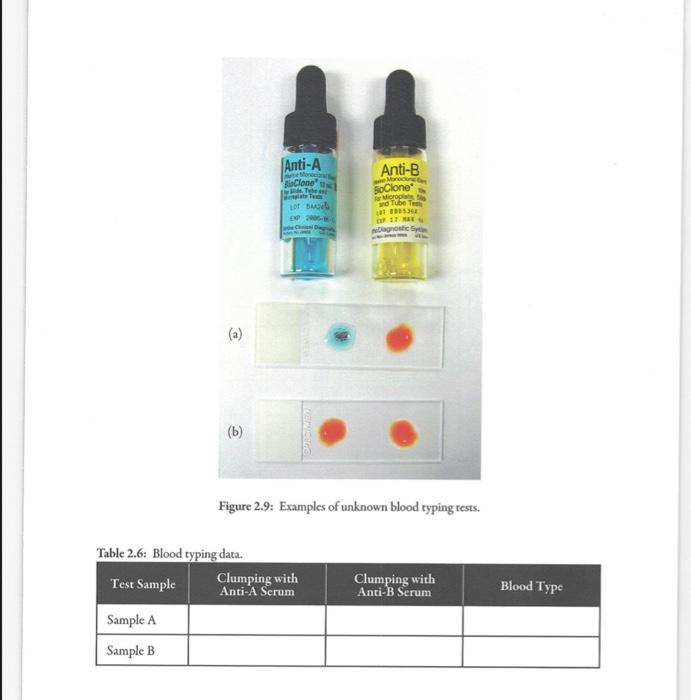 Solved Figure 2.9: Examples of unknown blood typing tests. | Chegg.com