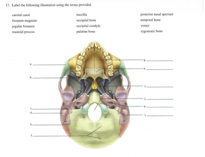 Solved 17. Label the following illustration using the terms | Chegg.com