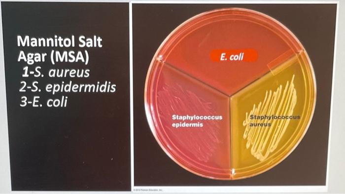 Eosin-Methylene Blue Agar (EMB) - Looking at the | Chegg.com