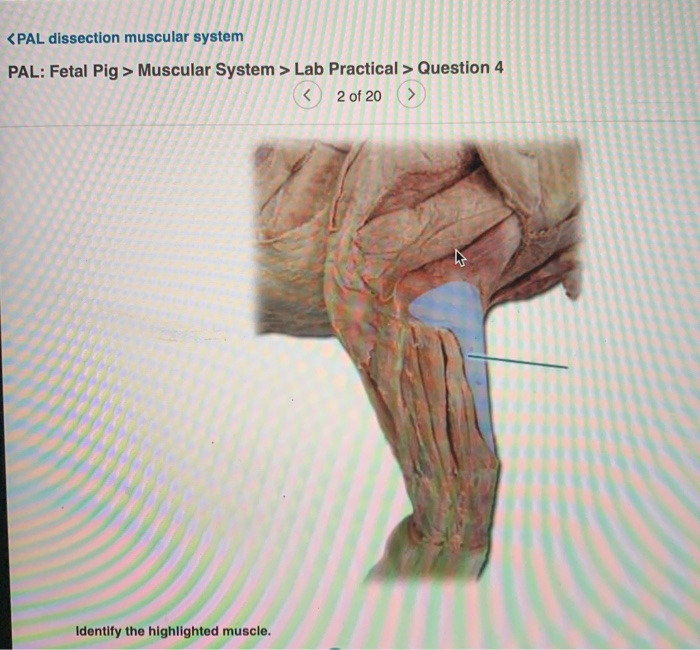 Solved Muscular System > Lab Practical > Question 3 1 of 20 | Chegg.com