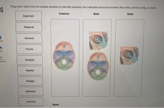Solved Drag each label into the proper position to identify | Chegg.com Solved Drag each label into the proper position to identify | Chegg.com