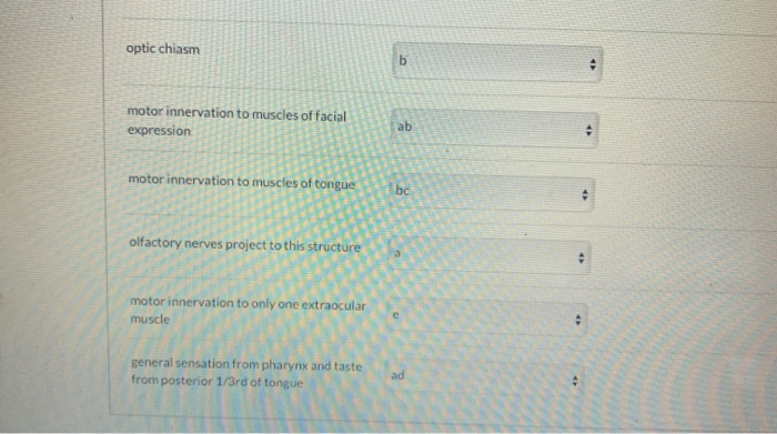 Solved Match the statement with the correct structure | Chegg.com