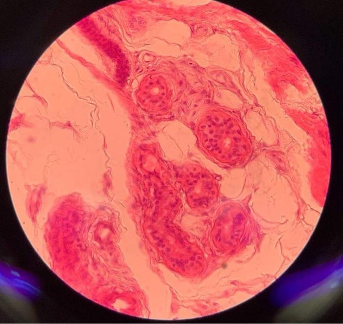 Solved Human Palm Skin: Oil or Sebaceous Gland Parts | Chegg.com