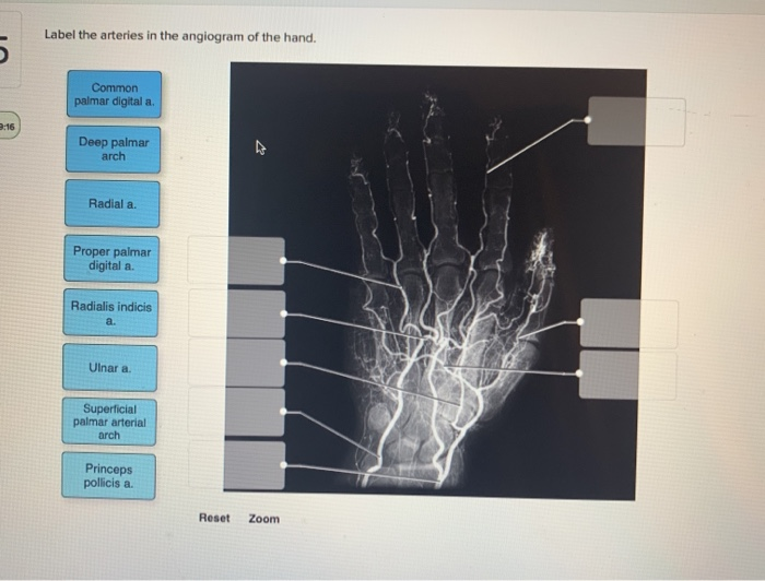 Solved Label the arteries in the angiogram of the hand. | Chegg.com