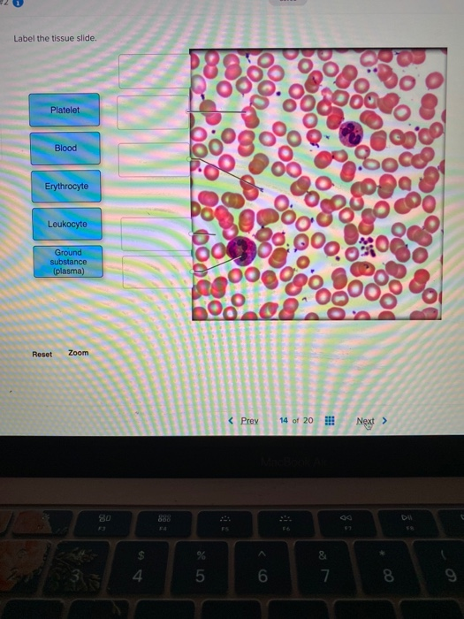 Solved 20 Saved Label the structures on this tissue slide. | Chegg.com