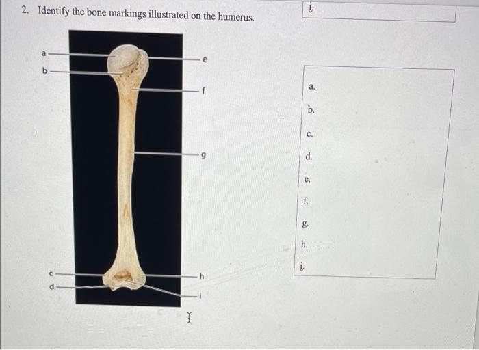 Solved 2. Identify the bone markings illustrated on the | Chegg.com
