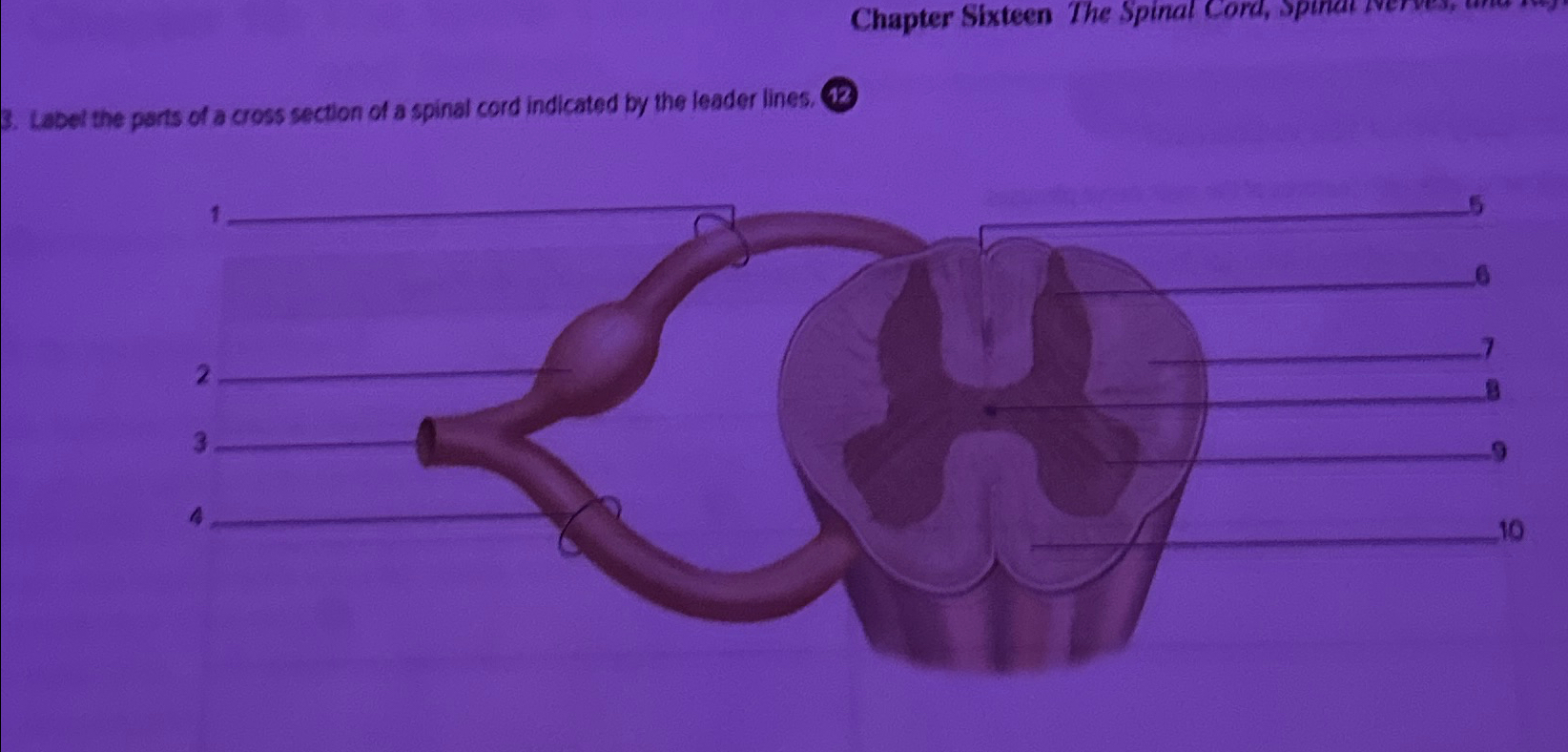 Solved Chapter Sixteen The Spinal Cord, spind3. ﻿Label the | Chegg.com