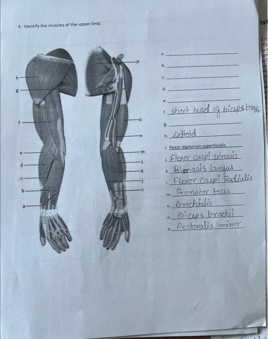 Solved 4. Identify the muscles of the upper limb. a. b. c. | Chegg.com