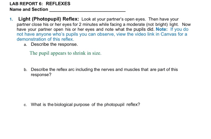 Solved LAB REPORT 6: REFLEXES Name and Section 1. Light | Chegg.com
