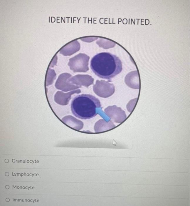 Solved IDENTIFY THE POINTED CELL. O Chief cell O Chromophobe | Chegg.com