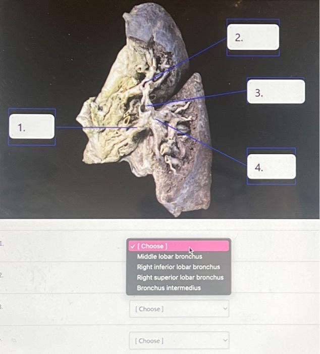 Solved 2. 3. 1. 4. [Choose Middle lobar bronchus Right | Chegg.com
