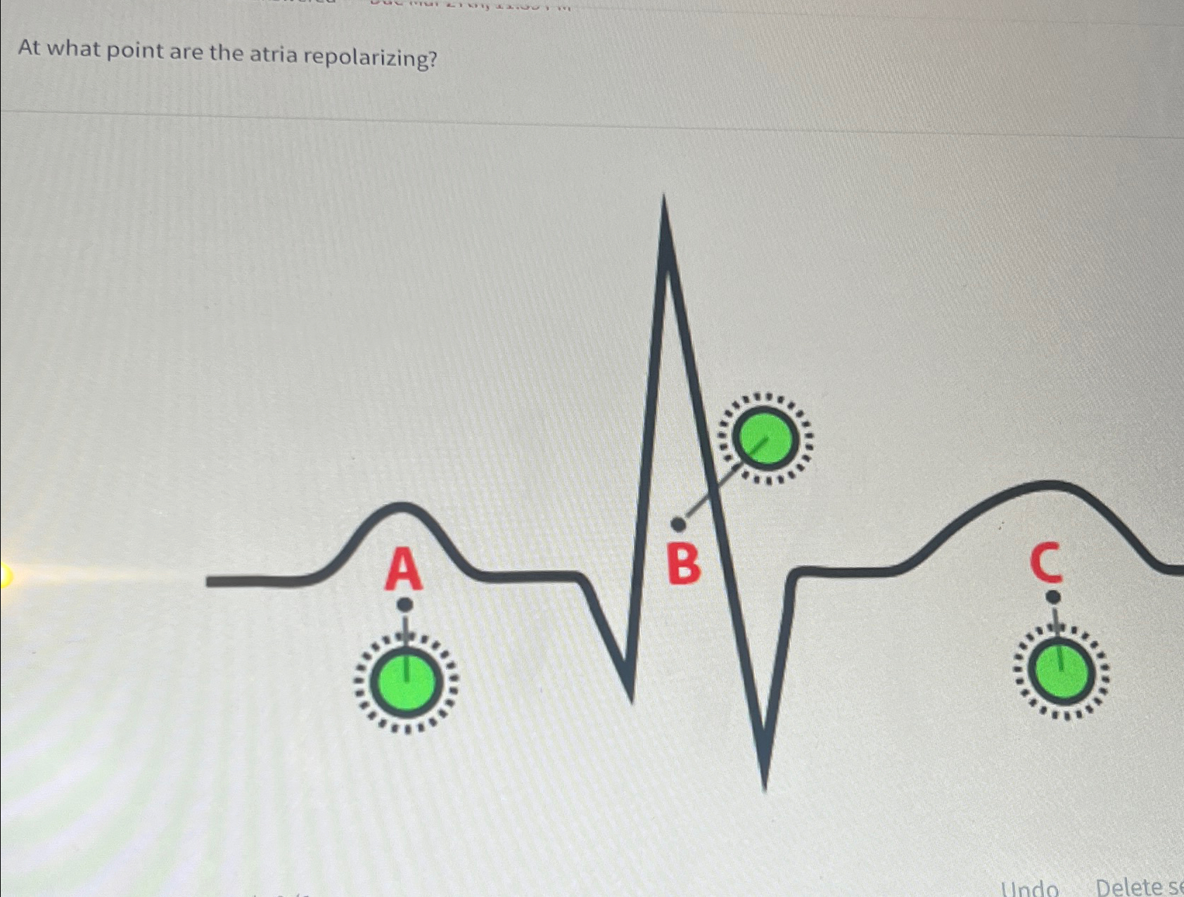 Solved At what point are the atria repolarizing? | Chegg.com
