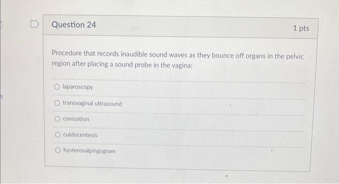 Solved Procedure that records inaudible sound waves as they | Chegg.com