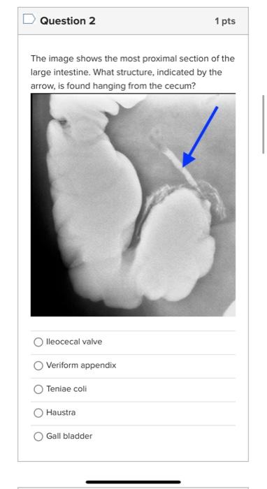 Solved The image shows the most proximal section of the | Chegg.com