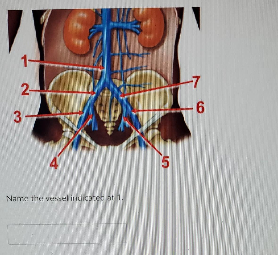 Solved Name the vessel indicated at 6. Name the vessel | Chegg.com