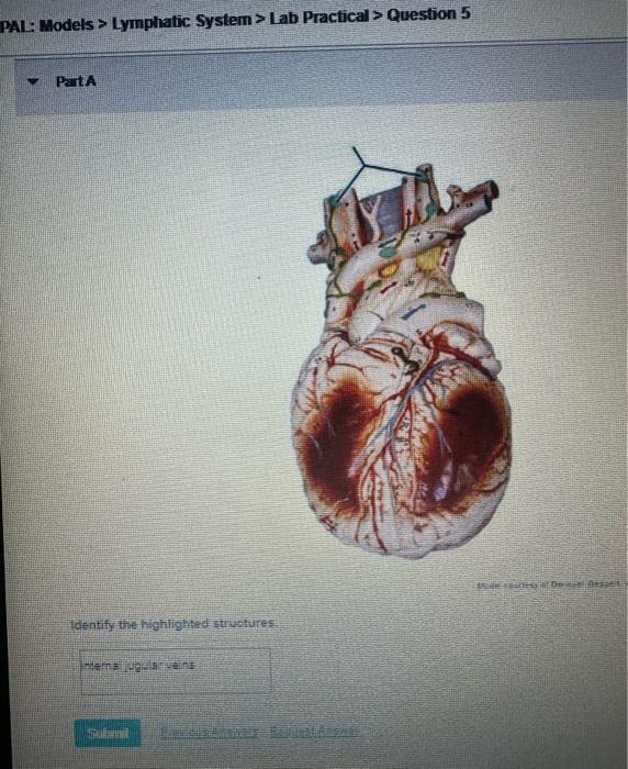 Solved PAL: Models > Lymphatic System > Lab Practical > | Chegg.com