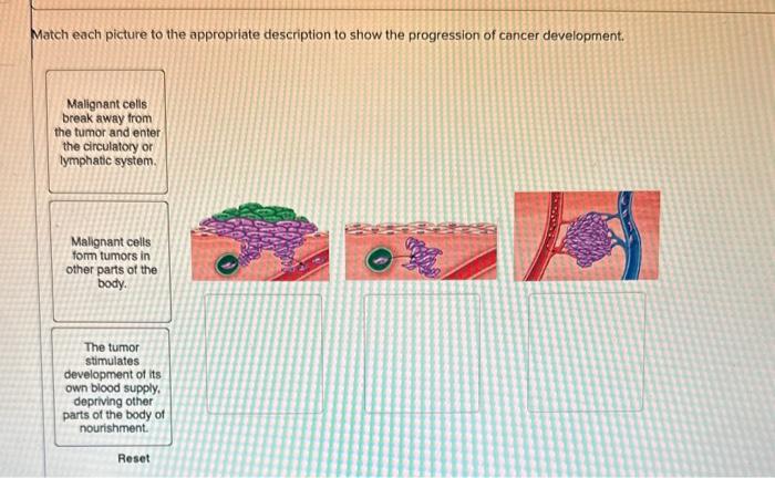 Solved Match each picture to the appropriate description to | Chegg.com