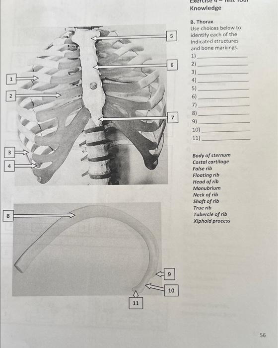 Solved Knowledge B. Thorax Use choices below to identify | Chegg.com