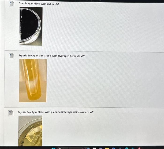 Solved Nutrient Agar, Culture Growth Gram stain Crystal | Chegg.com