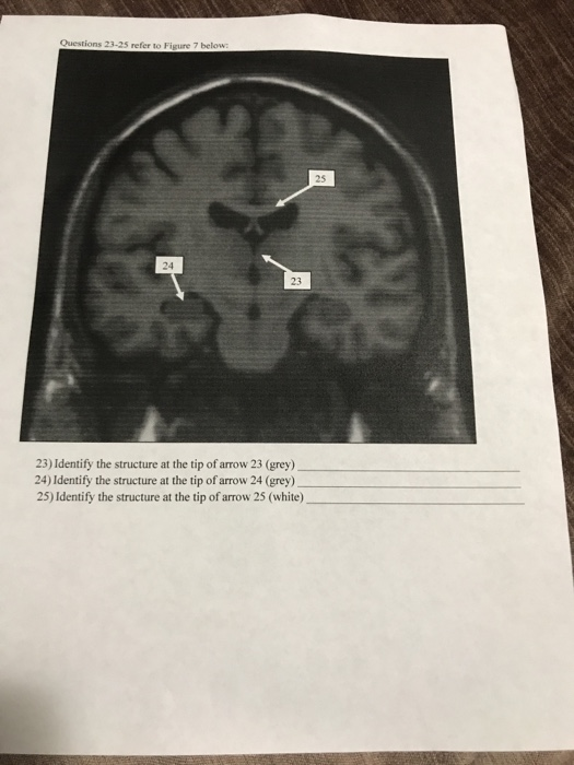 Solved General tips for reading an MRI: What type of slice | Chegg.com