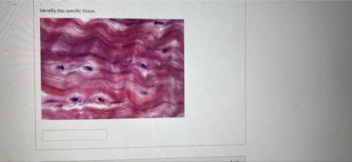 Solved Identify this specific tissue | Chegg.com