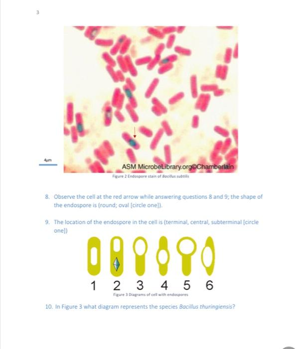 Solved um Figure 1 Endospore stained heat fixed smear at a | Chegg.com